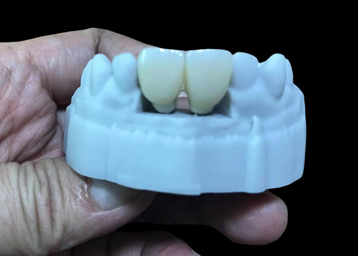 Replace Missing Teeth Dental Implant crown With Screw Titanium Base And ...