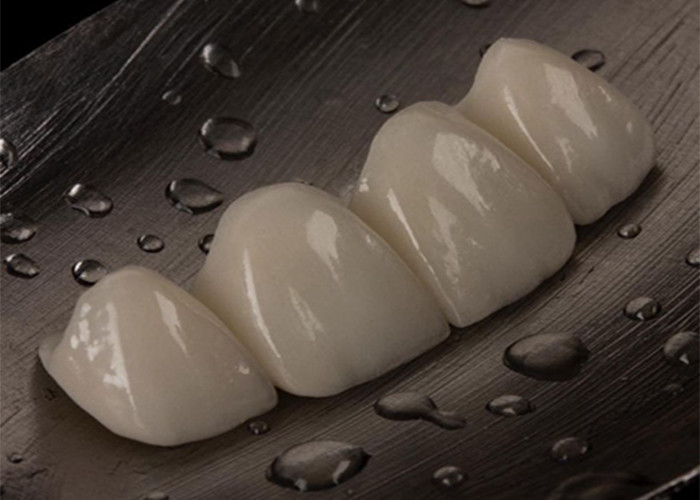 Customizable Ceramic Crown Bridge For Missing Tooth Comfortable Perfect Fit