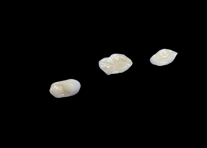 Biocompatible Ceramic Inlays and Onlays Designed for Comfort Durability ...