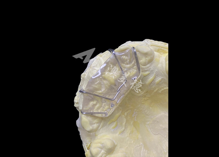 Inclined Plane Guide for Precision in Tooth Movement and Occlusion